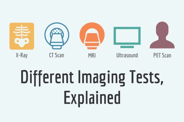 Worried About Radiation from an X-ray or CT Scan? | UVA Radiology Worried About Radiation from an X-ray or CT Scan? | UVA Radiology